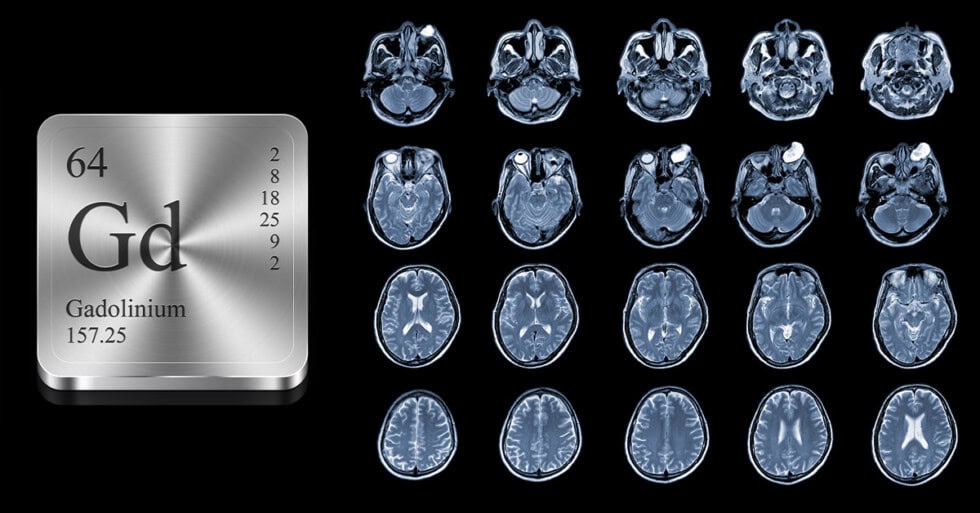 Beyond the scan: Risks of MRI contrast and gadolinium - America Out ...